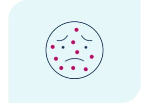 Measles Public Health Info - Public Health Communications Collaborative
